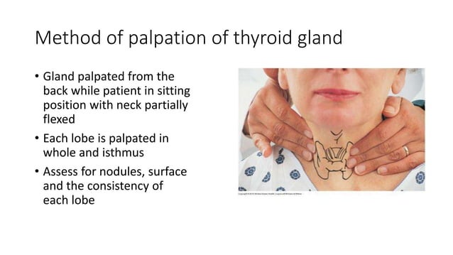 Thyroid.pptx | Free Download