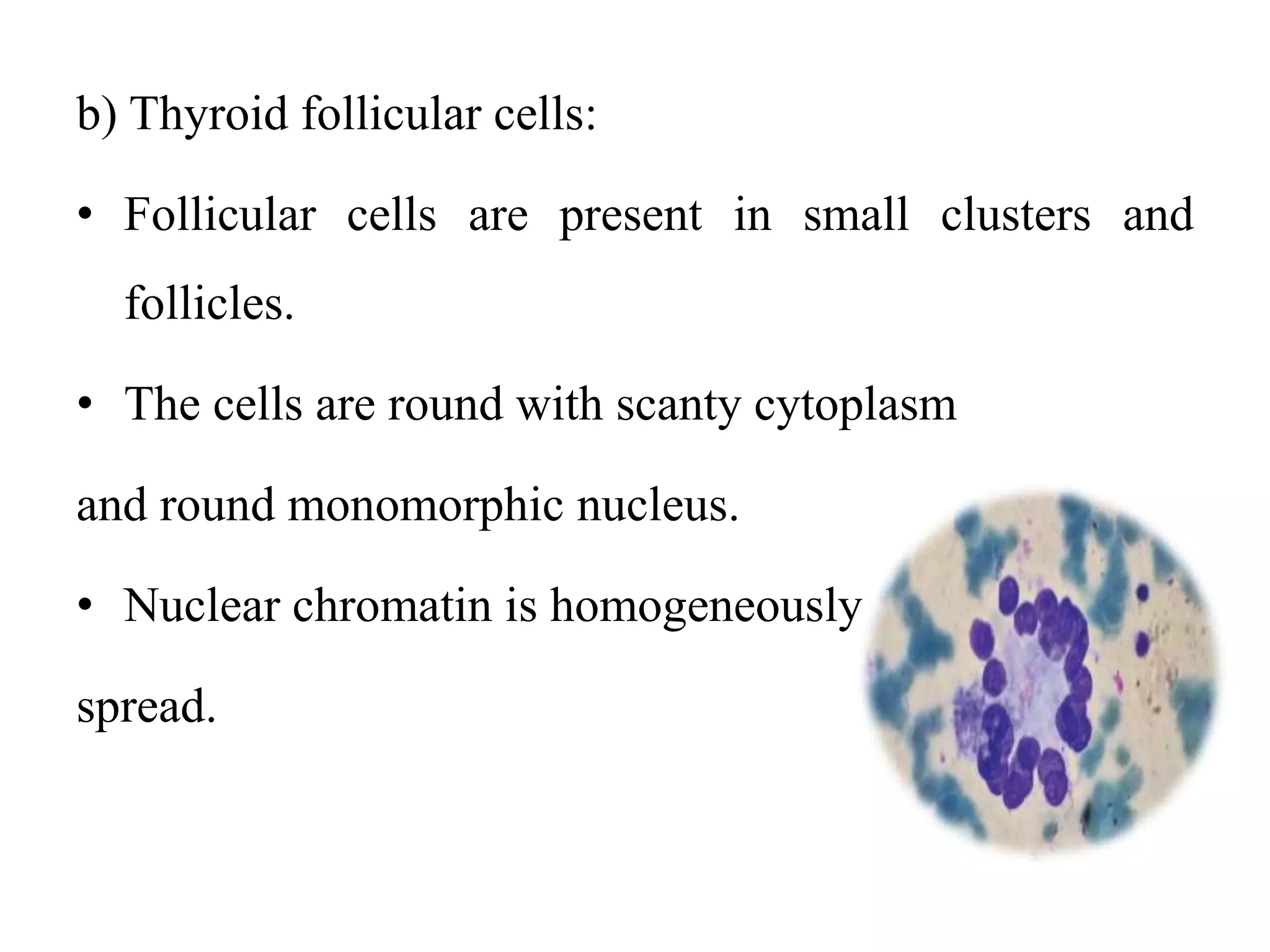 THYROID - cytology pptx | PPTX