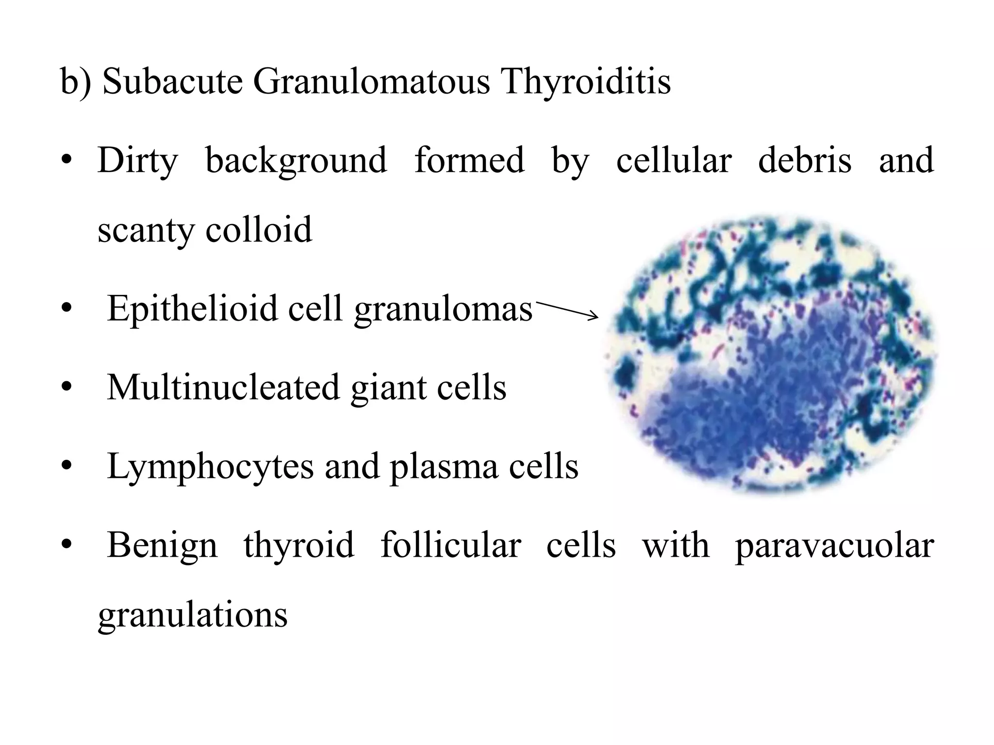 THYROID - cytology pptx | PPTX