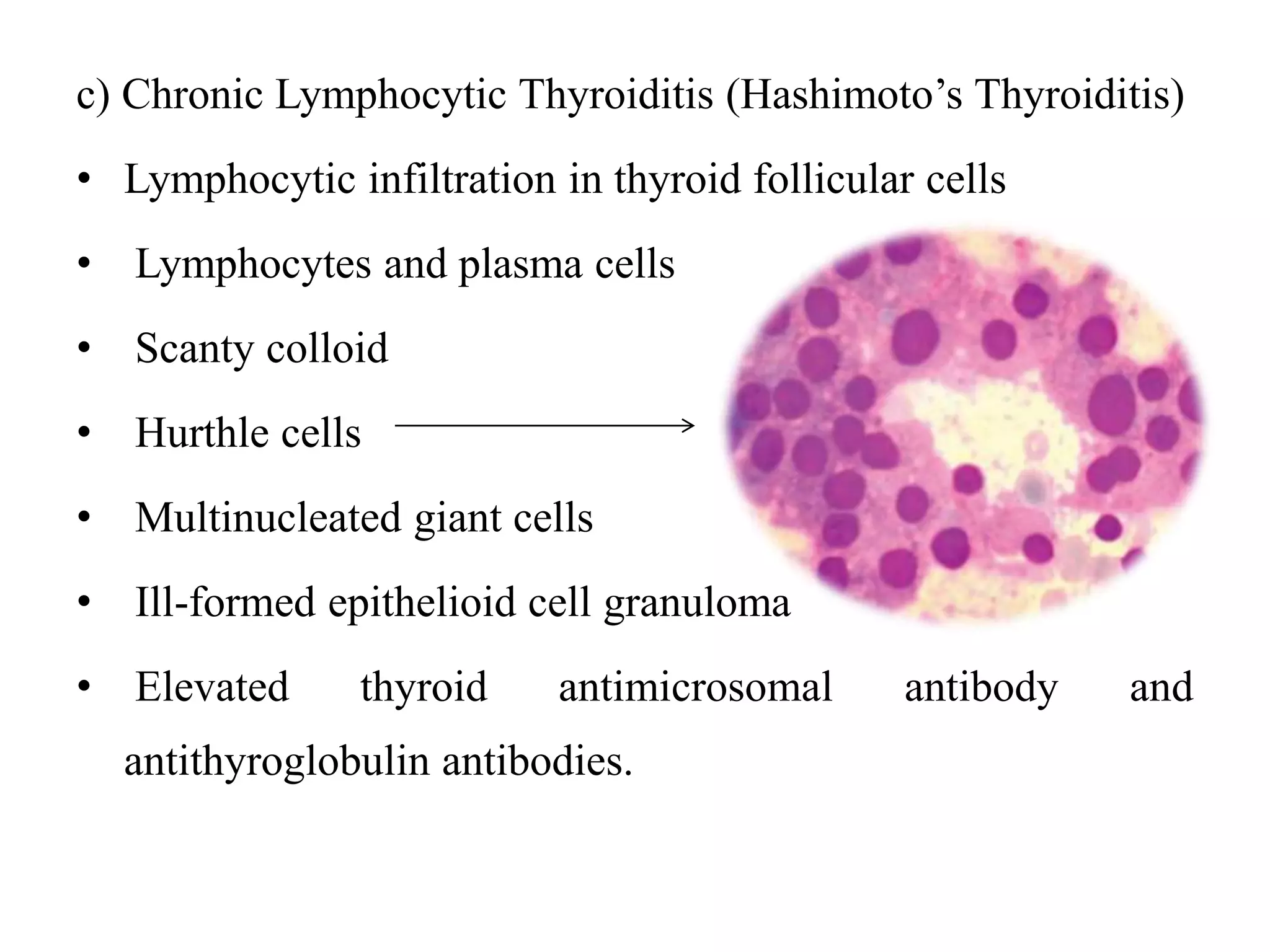 THYROID - cytology pptx | PPTX