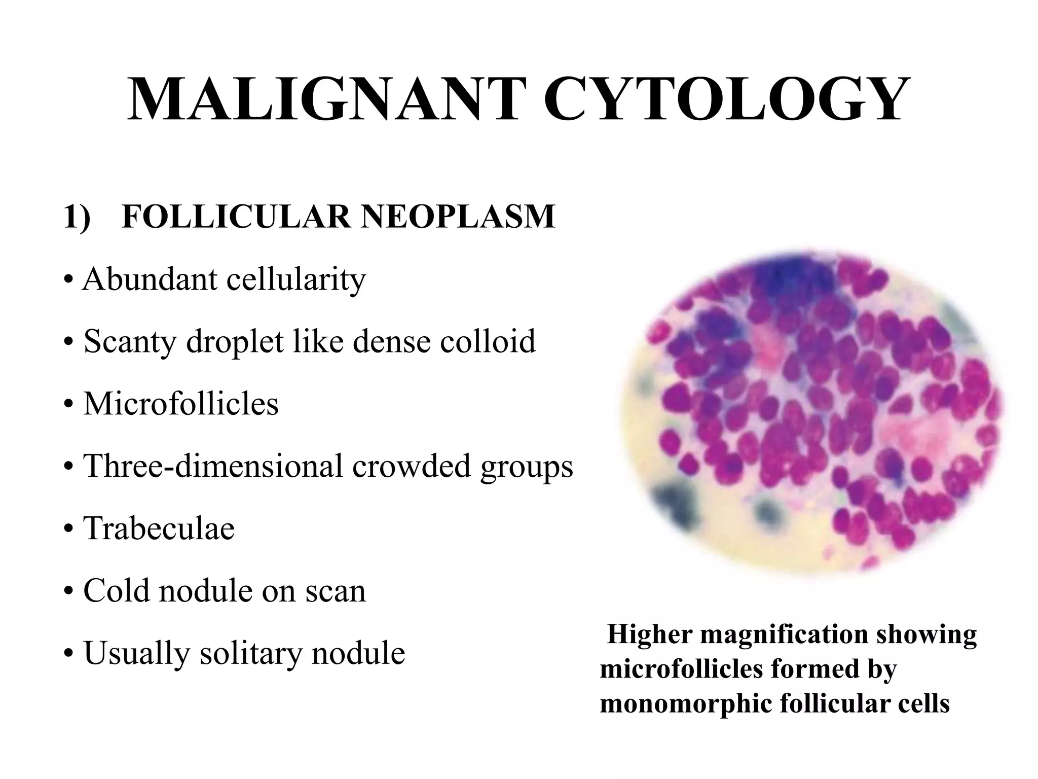 THYROID - cytology pptx | PPTX