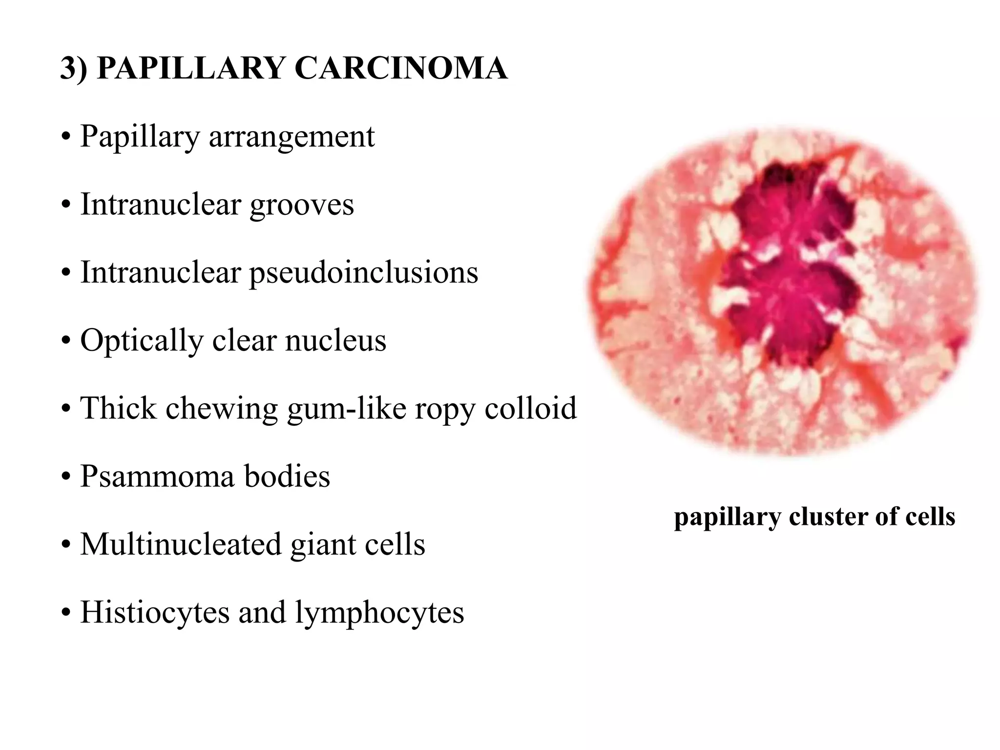 THYROID - cytology pptx | PPTX