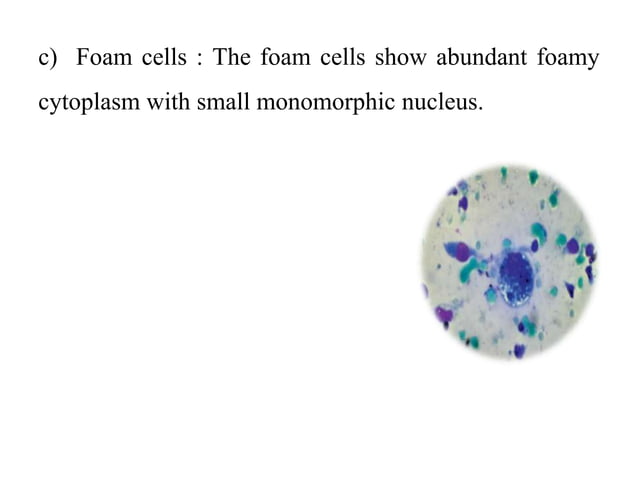 Thyroid Cytology Pptx Pptx Thyroid Disorders Endocrine And Metabolic Diseases
