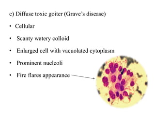THYROID - cytology pptx | PPTX