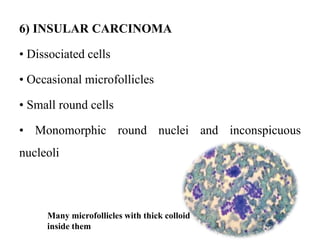 THYROID - cytology pptx | PPTX