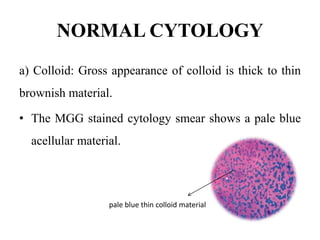 THYROID - cytology pptx | PPT