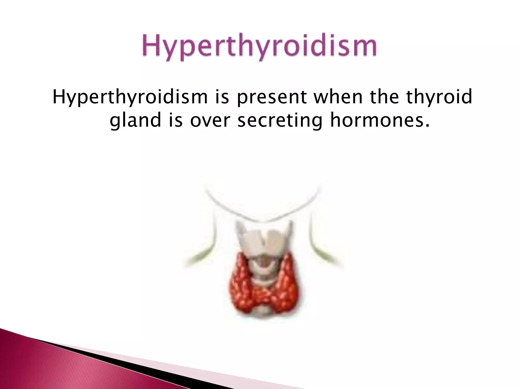 Thyroid.ppt | Thyroid Disorders | Endocrine and Metabolic Diseases