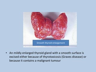 Thyroid.ppsx