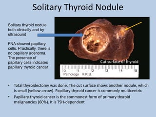 Thyroid.ppsx