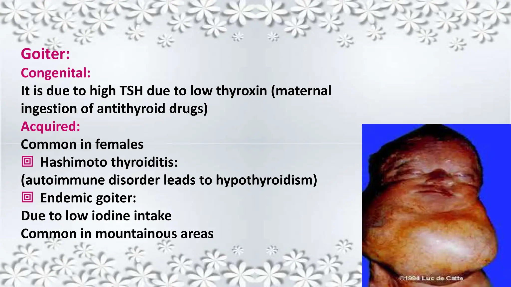 thyroid. Disorder hyperthyroidism and hypothyroidism | PPTX