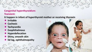 thyroid. Disorder hyperthyroidism and hypothyroidism | PPTX