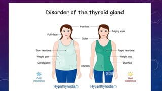 thyroid PREVENTION,TYPES AND ITS TREATMENT | PPT