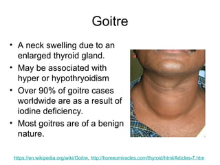 thyroid hormones, hyper/hypofunction.ppt