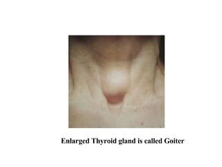 Thyroid | PPT