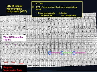 Thyroid and the Heart | PPT