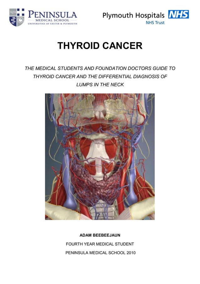 Thyroid Cancer & Differential Diagnosis of Lumps in Neck for Medical Students and Foundation ...