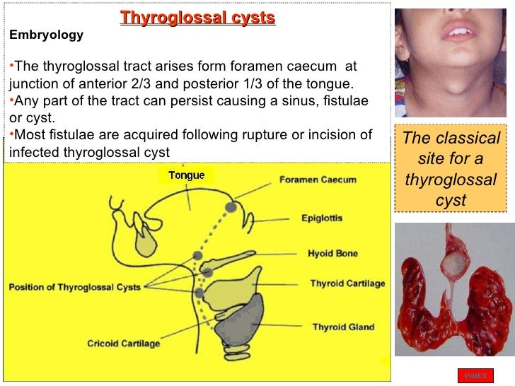 Thyroid presentation