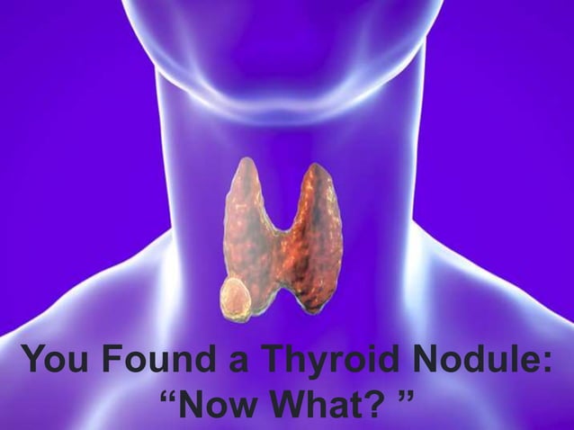 Approach To Thyroid Nodule Pptx