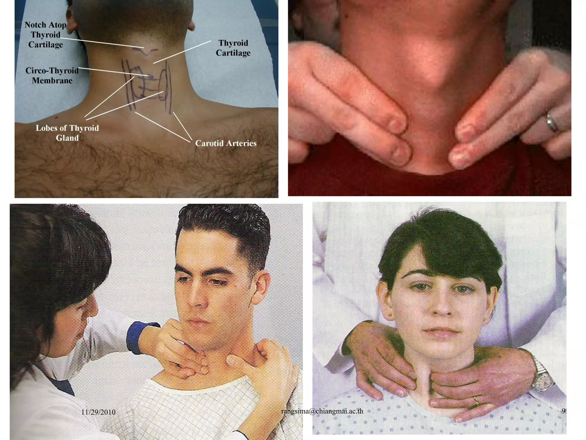 2010_Thyroid Examination | PDF