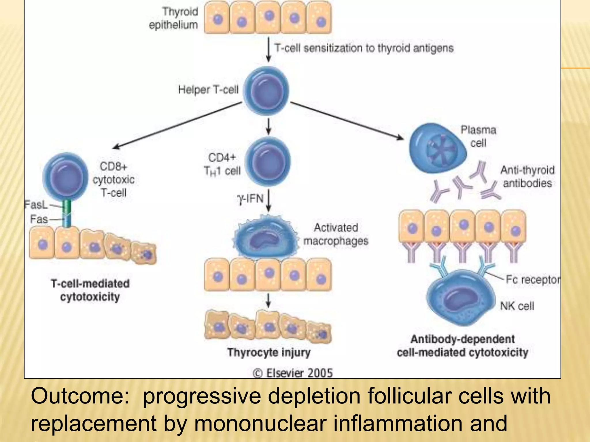 Thyroid anatomy and pathology | PPTX