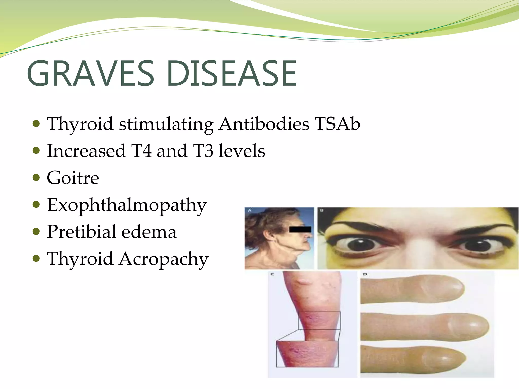 Thyroid and antithyroid drugs | PPTX
