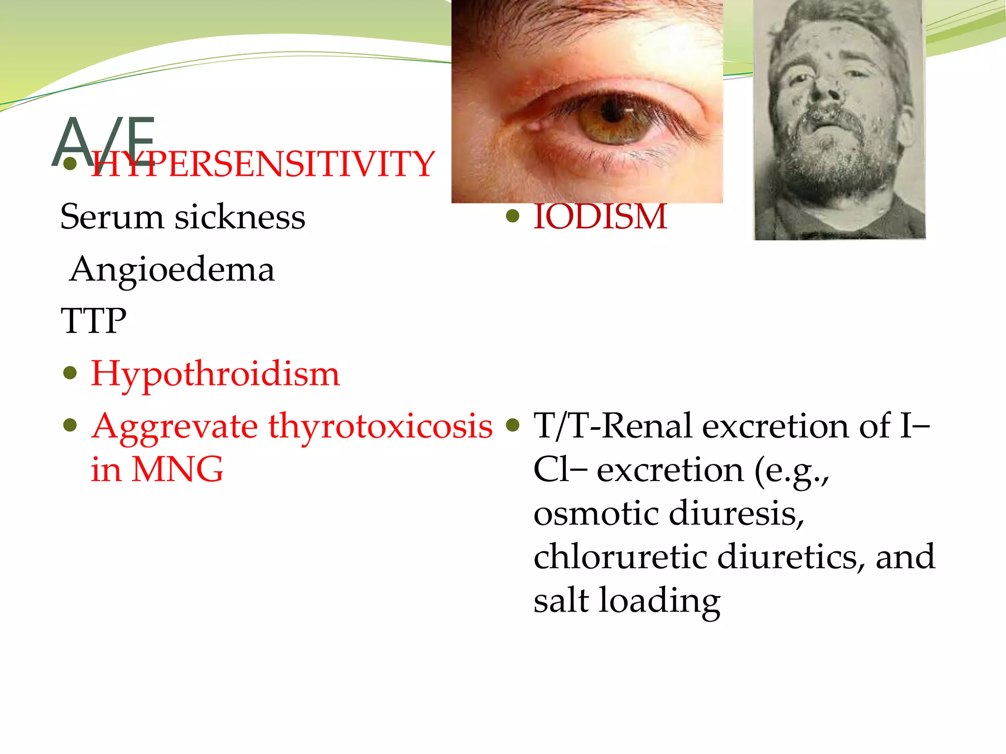 Thyroid and antithyroid drugs | PPTX