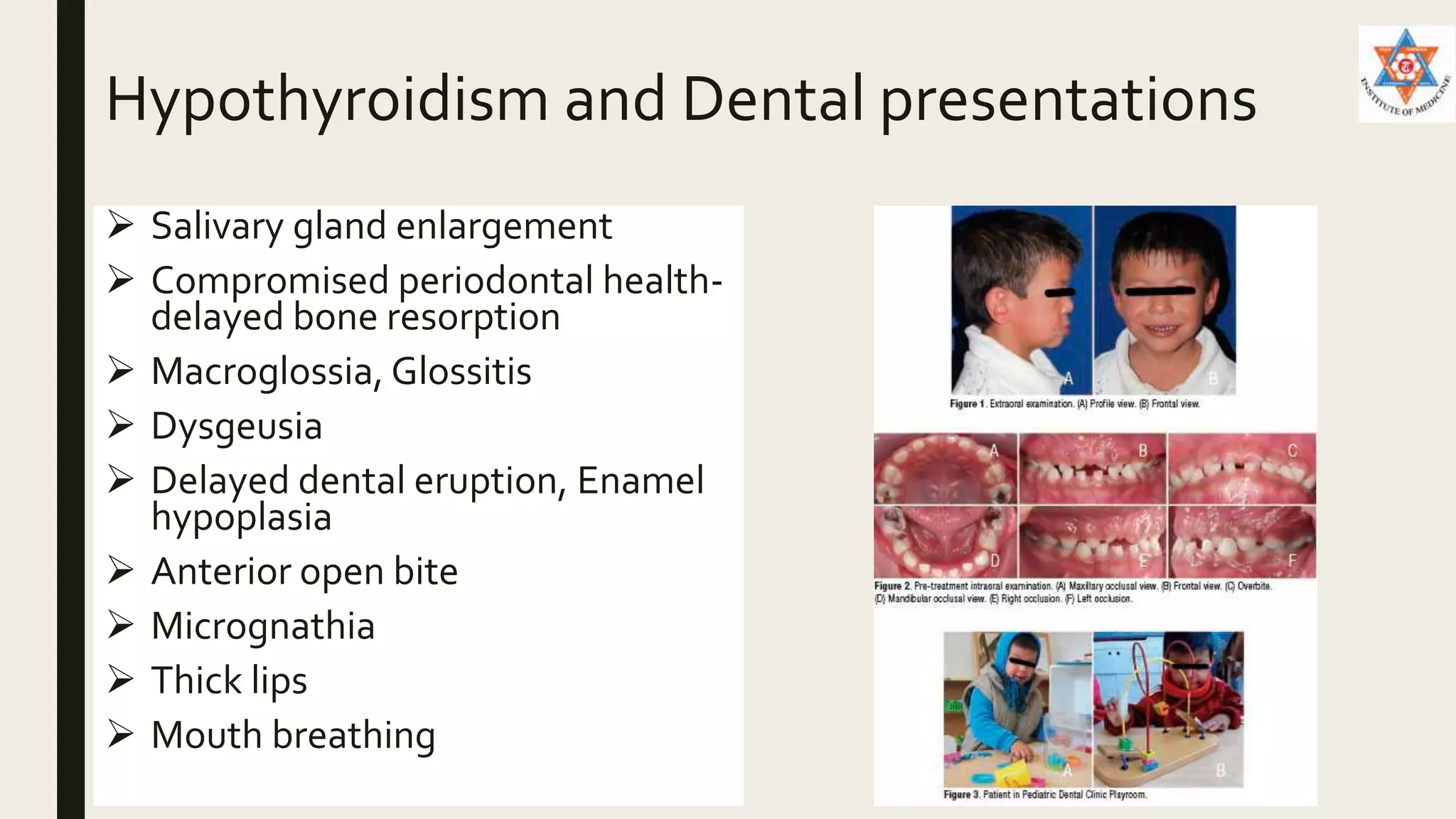 Thyroid and antithyroid drugs | PPTX