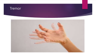 thyroid awarness.pptx