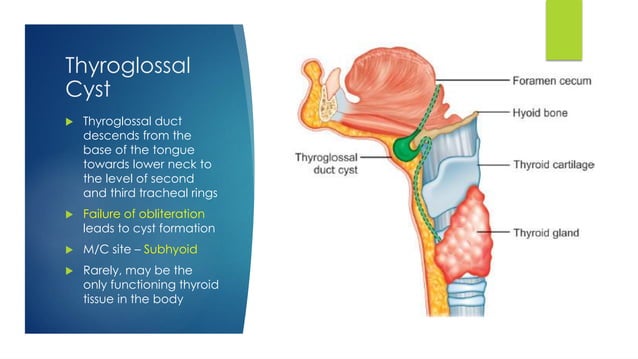 Thyroid basics and benign diseases | PPT