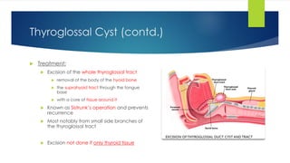 Thyroid basics and benign diseases | PDF