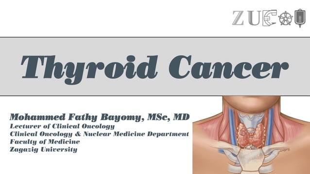 Thyroid cancer | PPT