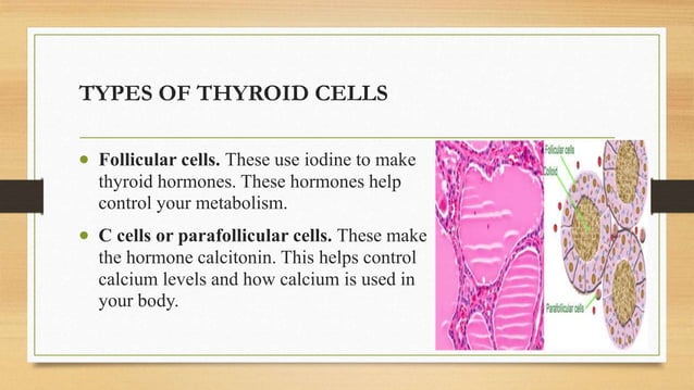 Thyroid cancer & hashimotos disease.pptx | Thyroid Disorders ...