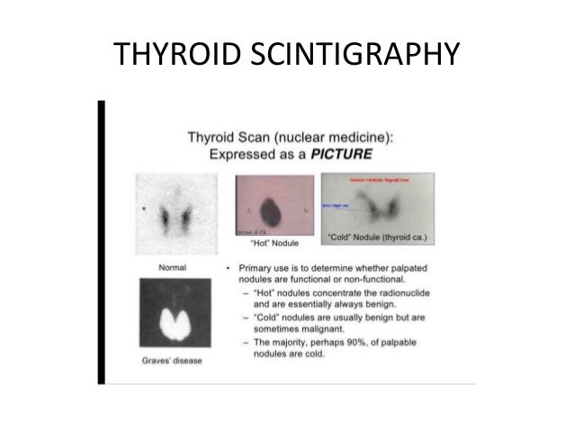 Thyroid cancer imaging