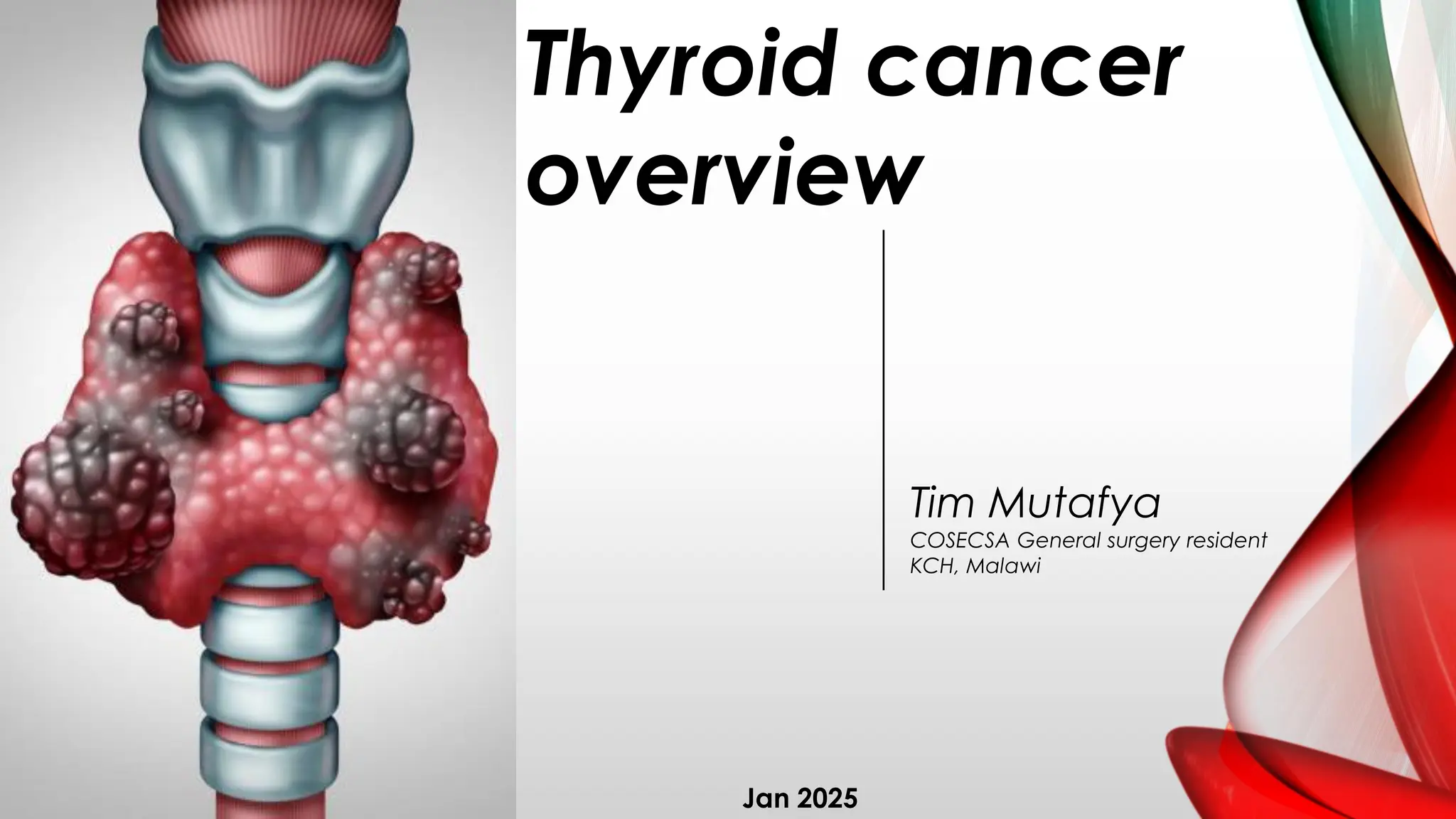 Thyroid cancer overview in global and African settings including Malawi ...