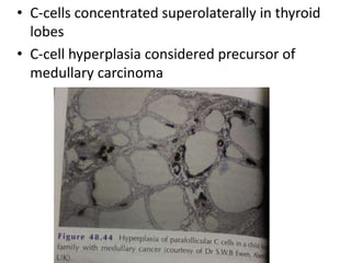 Thyroid cancers | PPTX