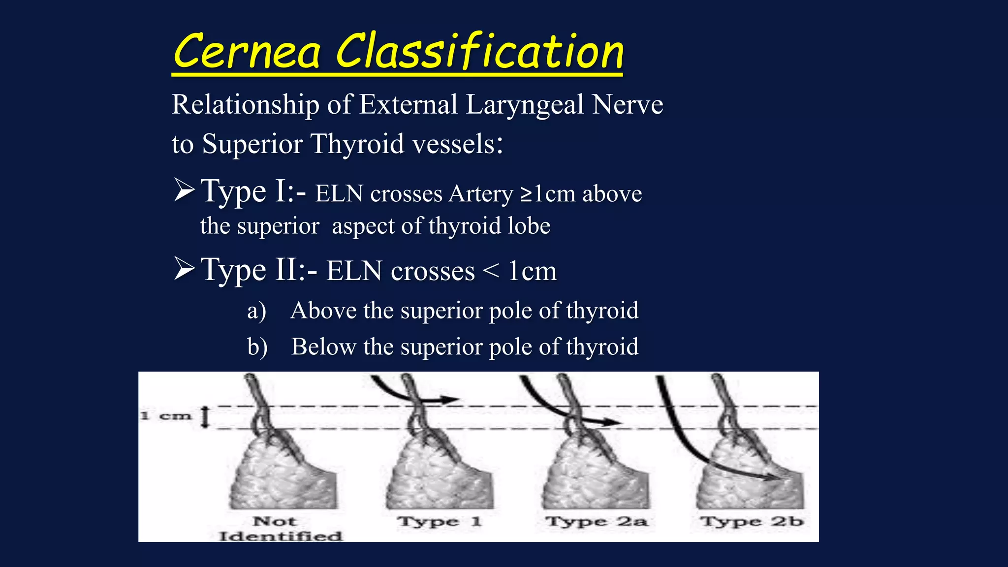 Thyroid carcinoma | PPTX