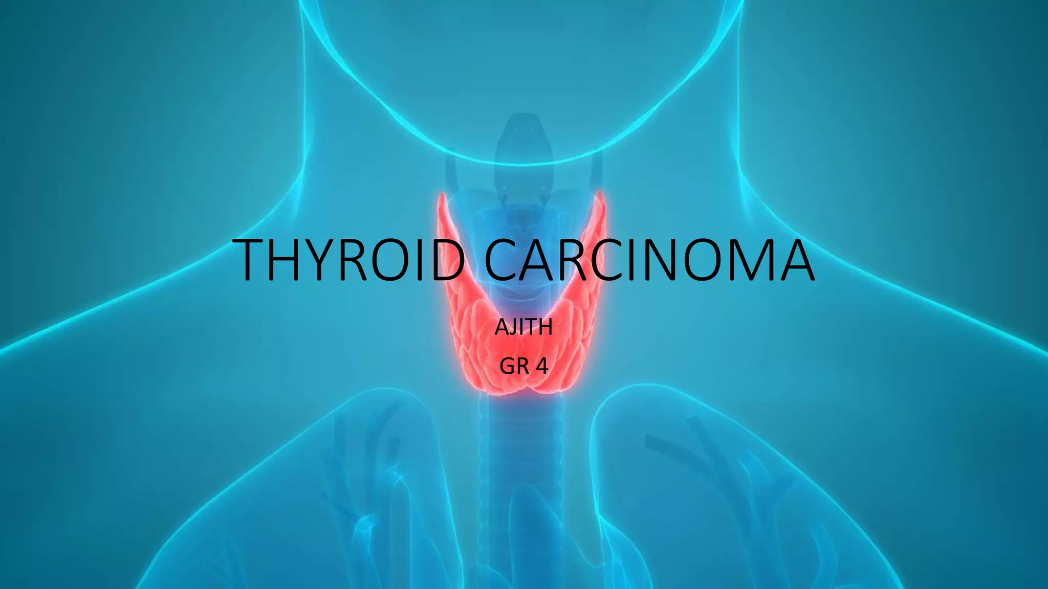 Thyroid Carcinoma Risks, Signs & Treatment Options | PPT