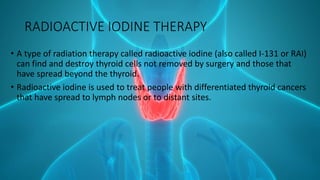 Thyroid carcinoma | PPTX