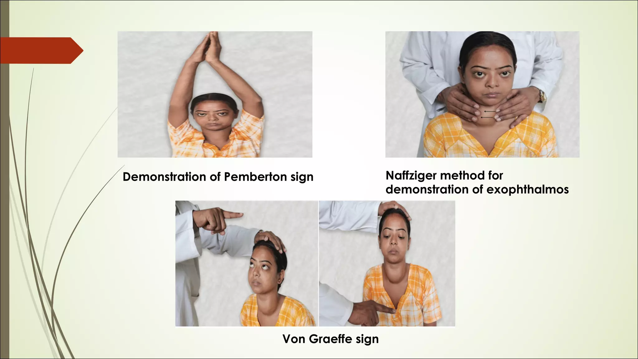 Thyroid Carcinoma.03