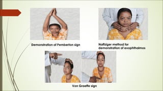 Thyroid Carcinoma.03