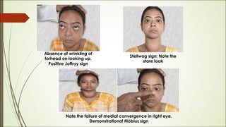 Thyroid Carcinoma.03