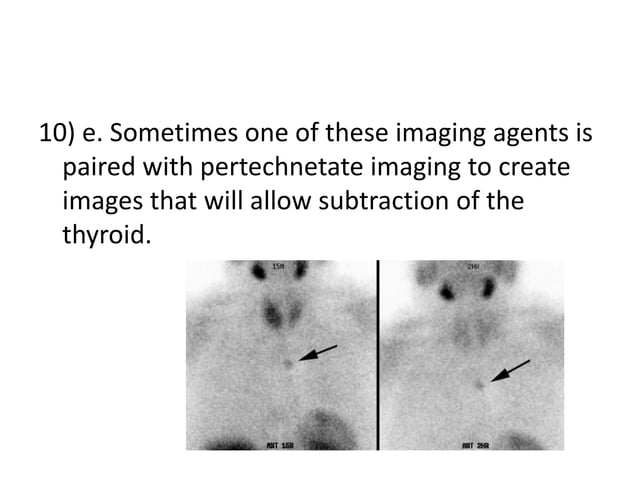 Nuclear Medicine - Thyroid, Parathyroid - Cases & Questions | PPTX ...