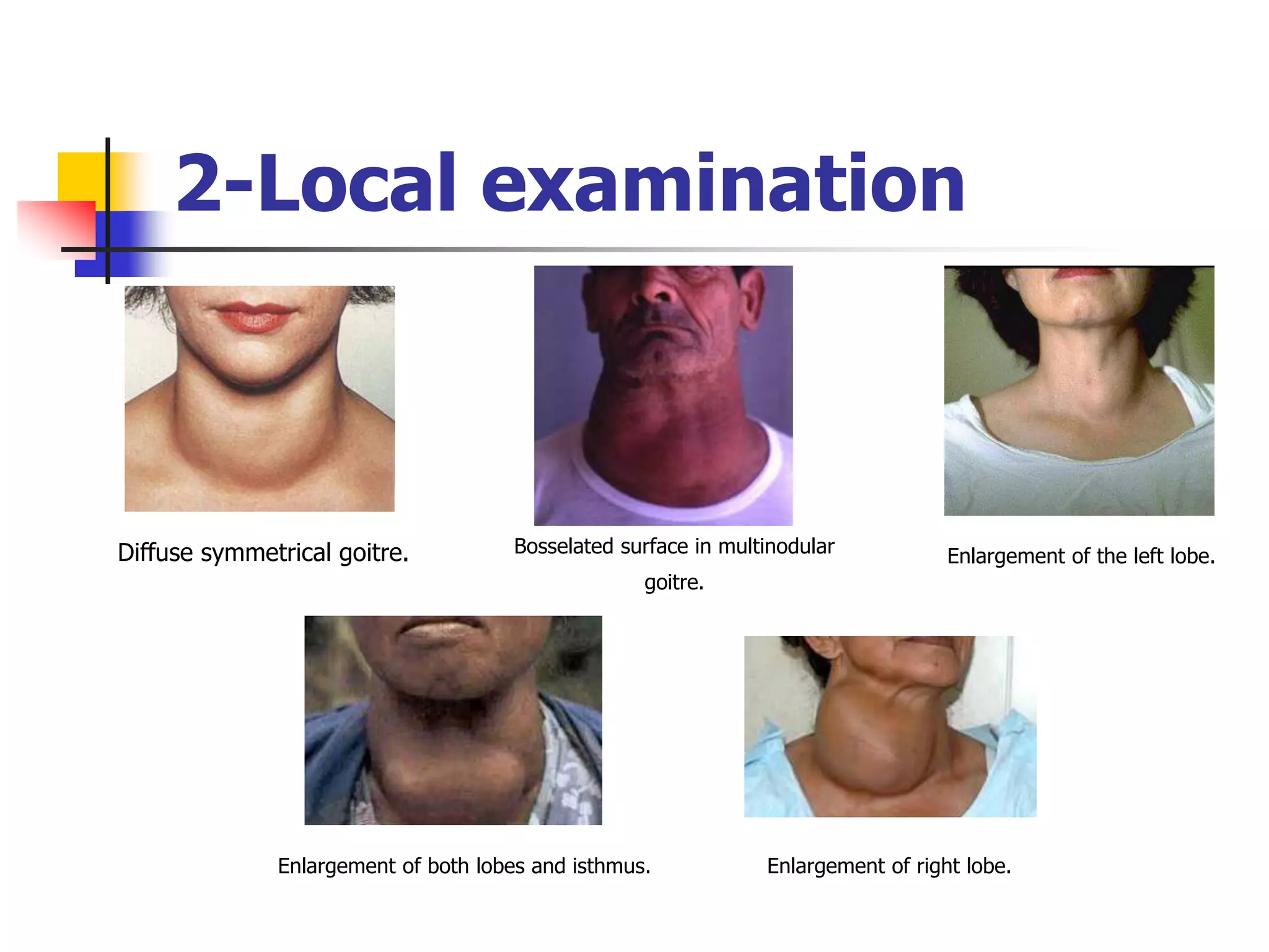Thyroid case sheet | PPT