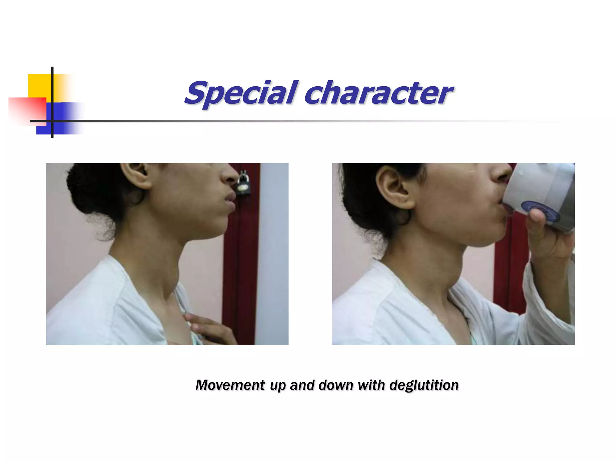 Thyroid Case Sheet Ppt