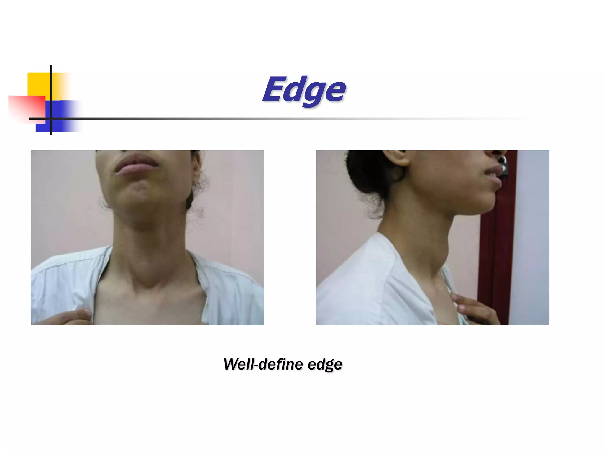 Thyroid case sheet | PPT