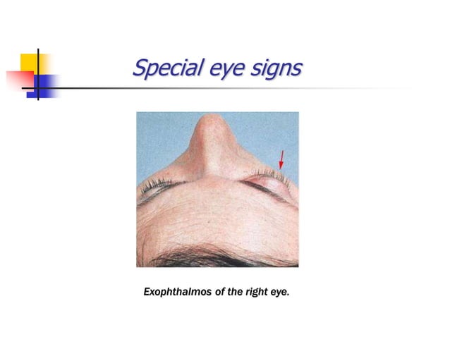 Thyroid Case Sheet Ppt