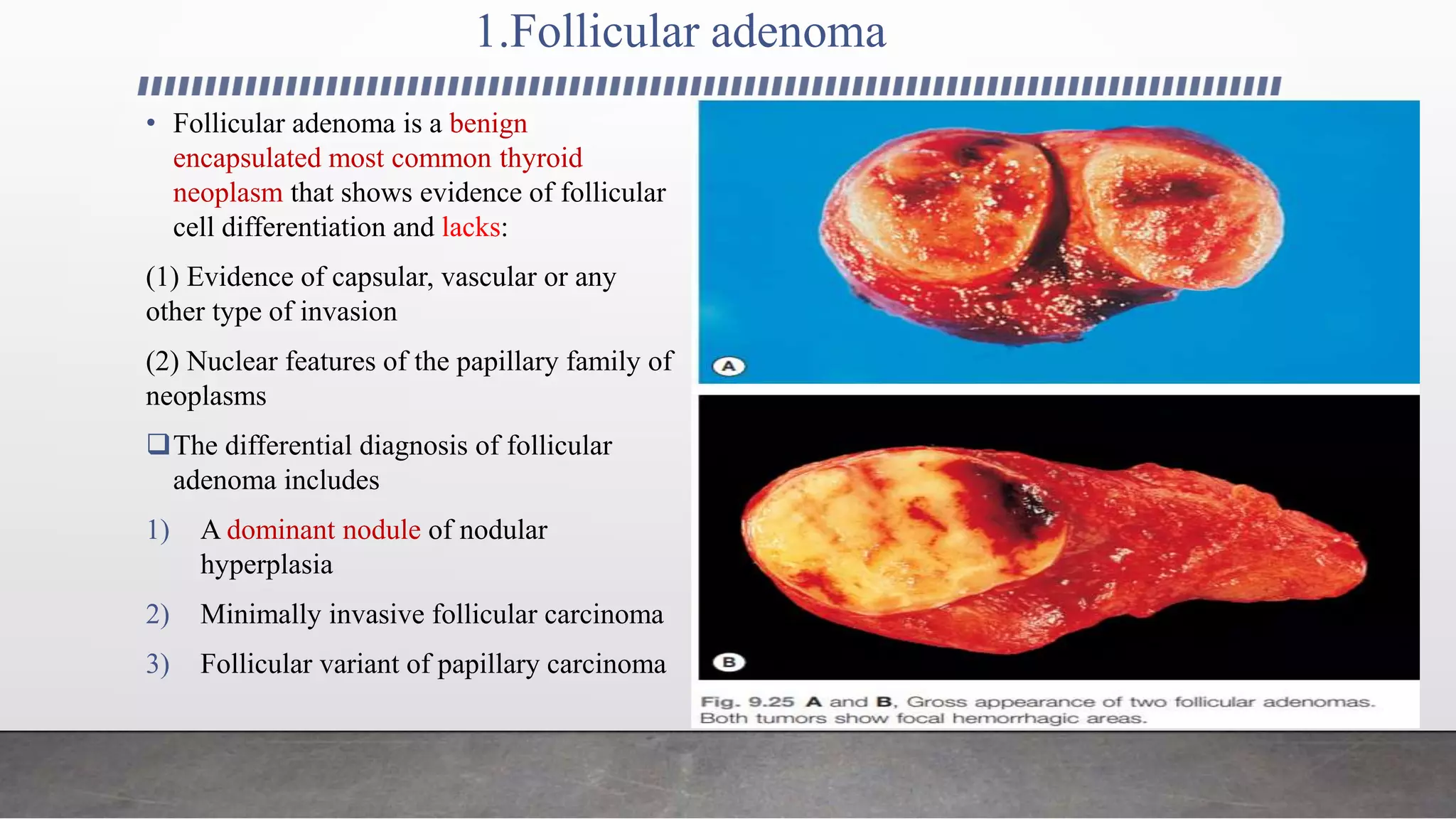 Cytohistological Correlation Of Malignant Thyroid Lesions | PPTX