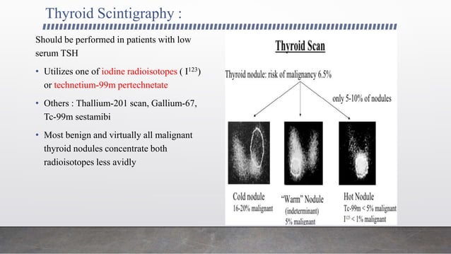 Cytohistological Correlation Of Malignant Thyroid Lesions | PPT
