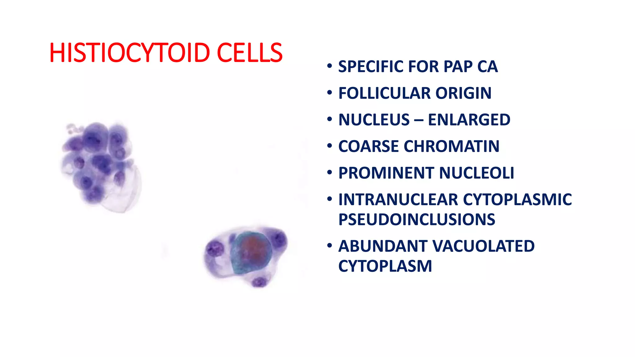 Papillary Carcinoma thyroid cytology.pptx