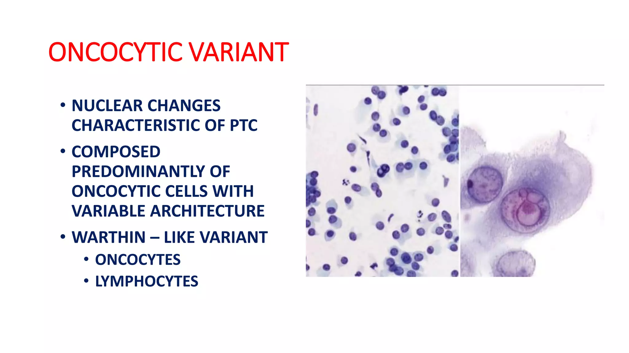 Papillary Carcinoma thyroid cytology.pptx